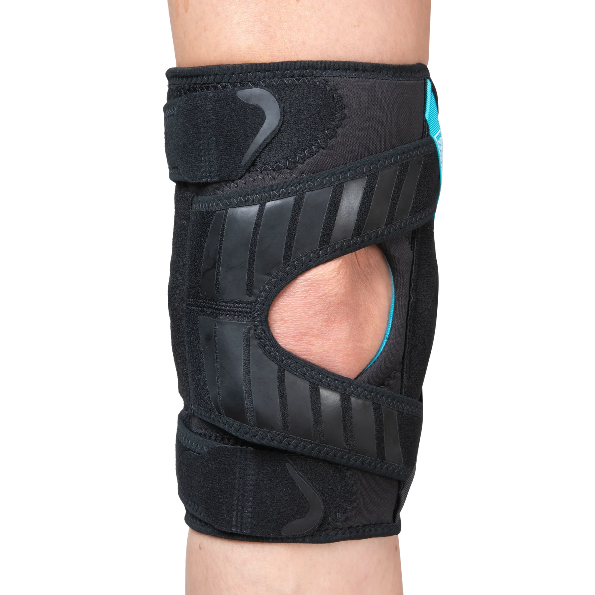 Ossur Formfit Tracker – Orthoquest Pedorthics and Rehabilitation